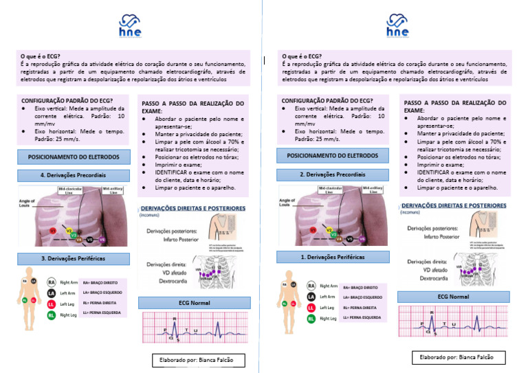 Folder Ecg | PDF | Eletrocardiografia | Eletrofisiologia
