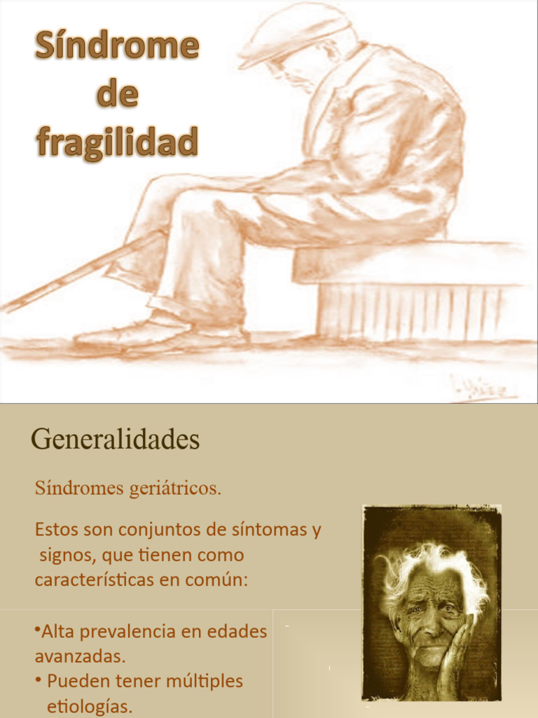 Sdx-Fragilidad ZTR | PDF | Vejez | Geriatría