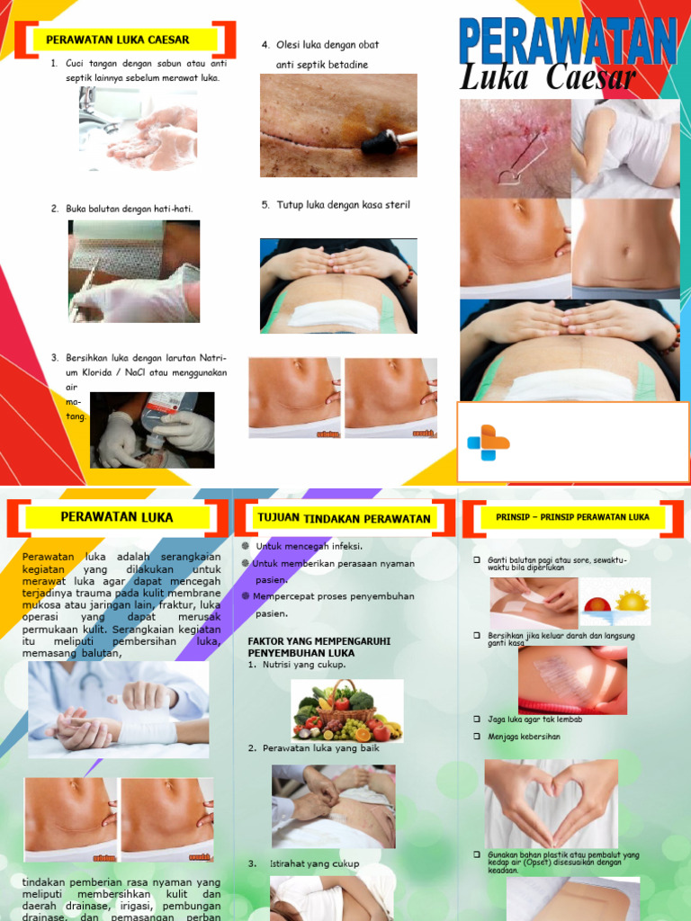 Leaflet Perawatan Luka Post SC | PDF