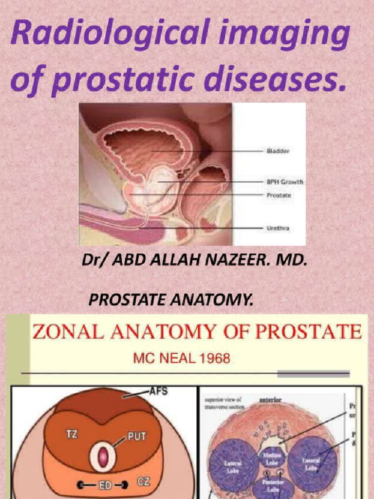 Presentation1pptx Radiological Imaging of Prostatic Diseases 38203086 | PDF