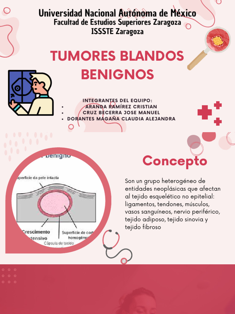 Tumores Blandos Benignos - 20240704 - 075411 - 0000 | PDF | Neoplasias | Enfermedades y trastornos