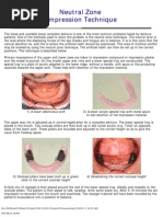 RPI and RPA Concept | PDF | Dentures | Dentistry Branches