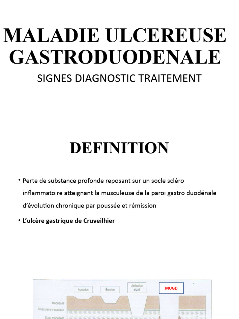 Ulcère Gastroduodénal : Diagnostic et Risques | PDF | Estomac ...