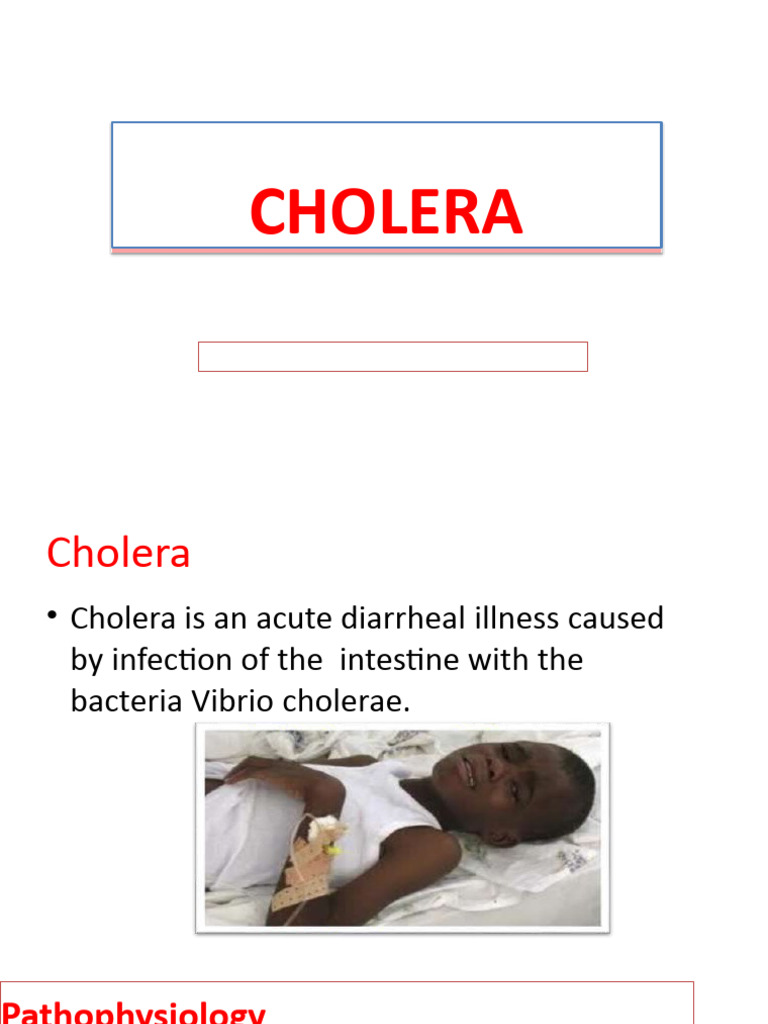 Cholera UP | PDF | Cholera | Dehydration