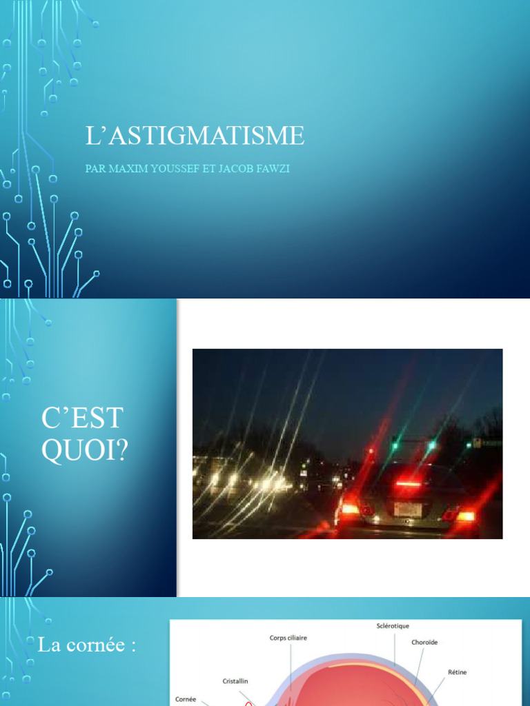 Comprendre l'astigmatisme et ses causes | PDF