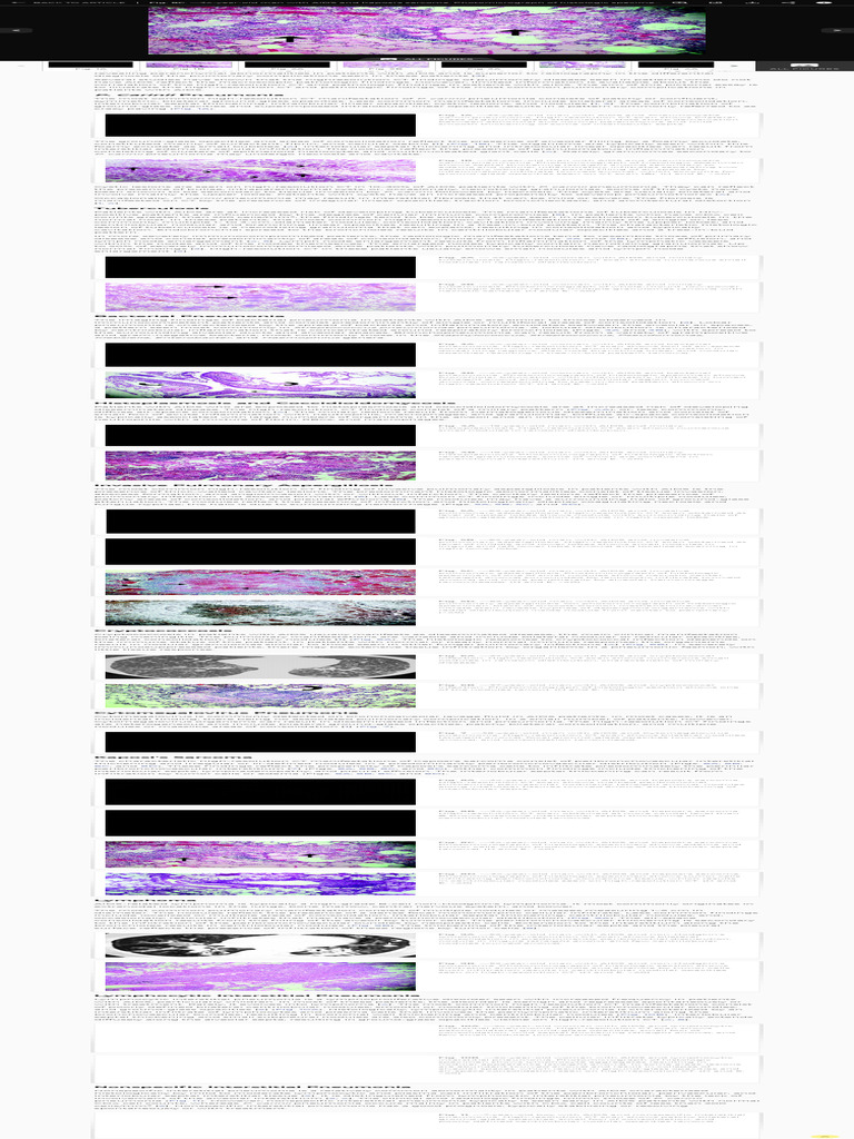Pulmonary Disease in Patients With AIDS High-Resolution CT and Pathologic Findings AJR | PDF ...