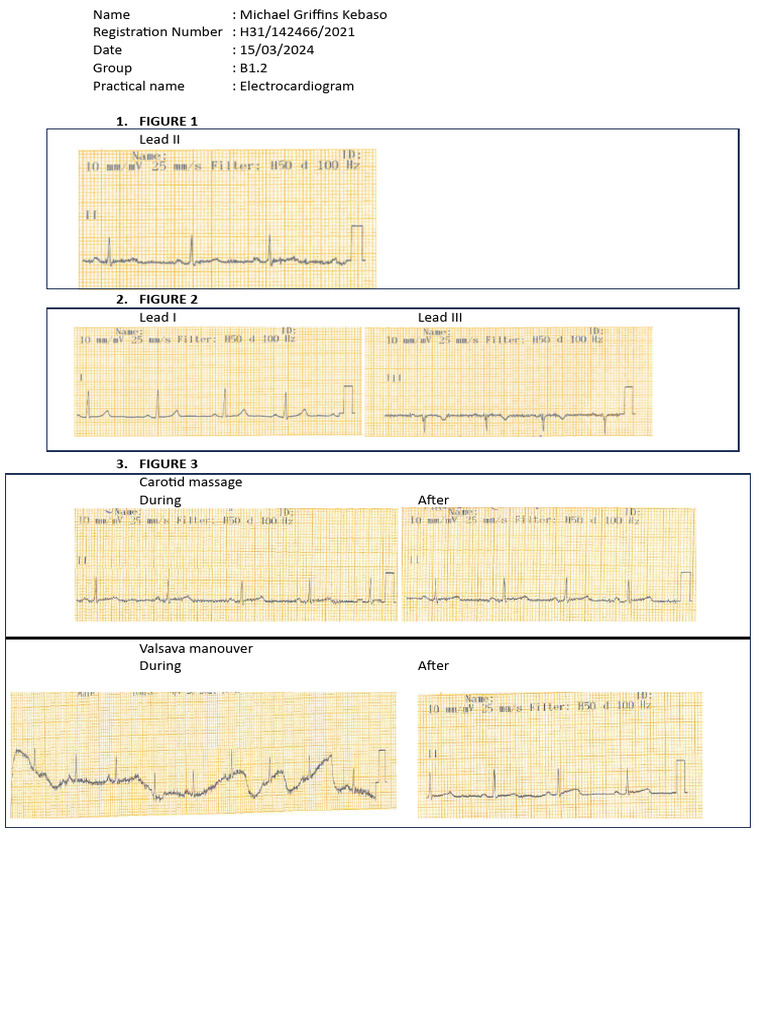 Complete | PDF | Heart Rate | Heart