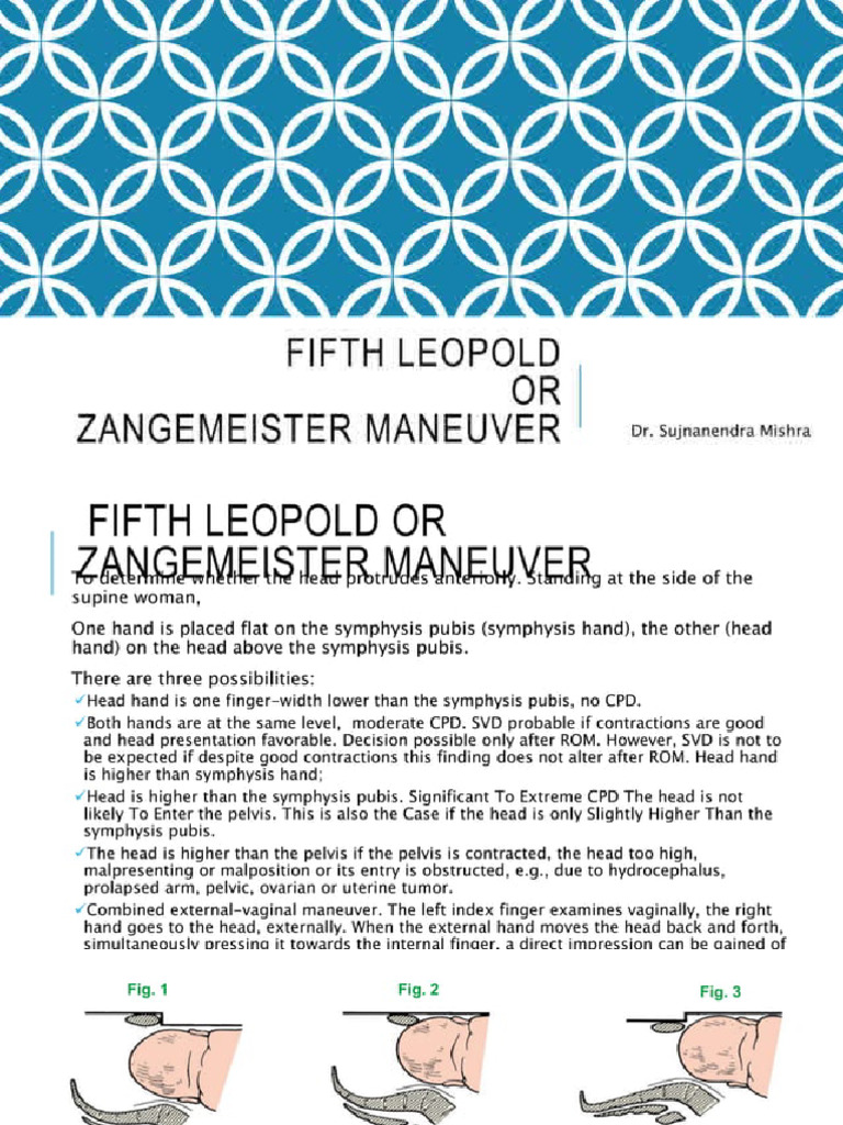 Leopold V 5 or Zangemeister Maneuver Atau Vasten Sign | PDF
