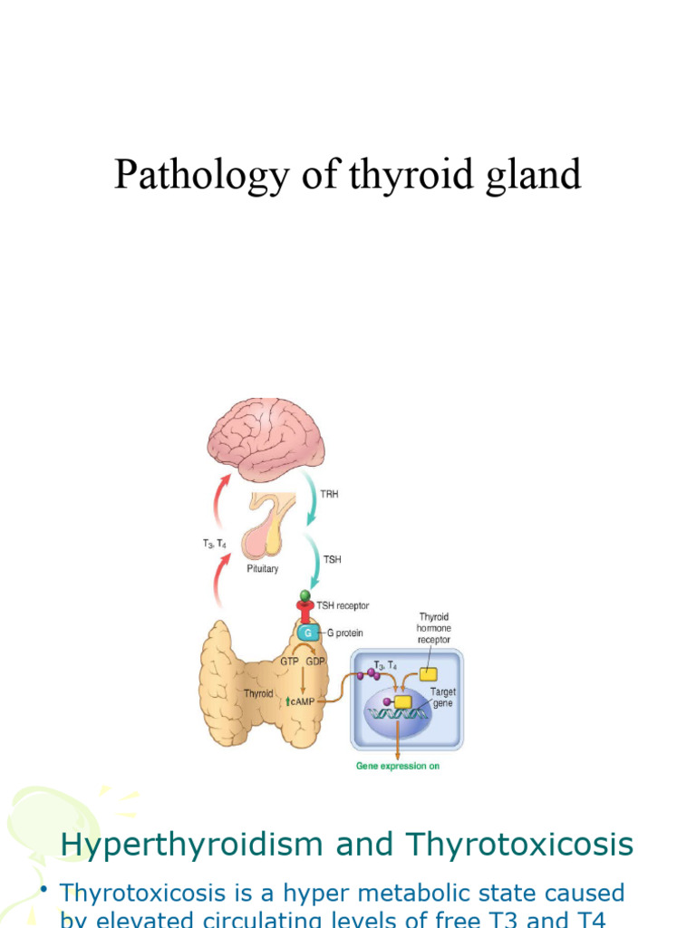 Thyroid Gland Pathology Final | PDF | Thyroid | Hyperthyroidism
