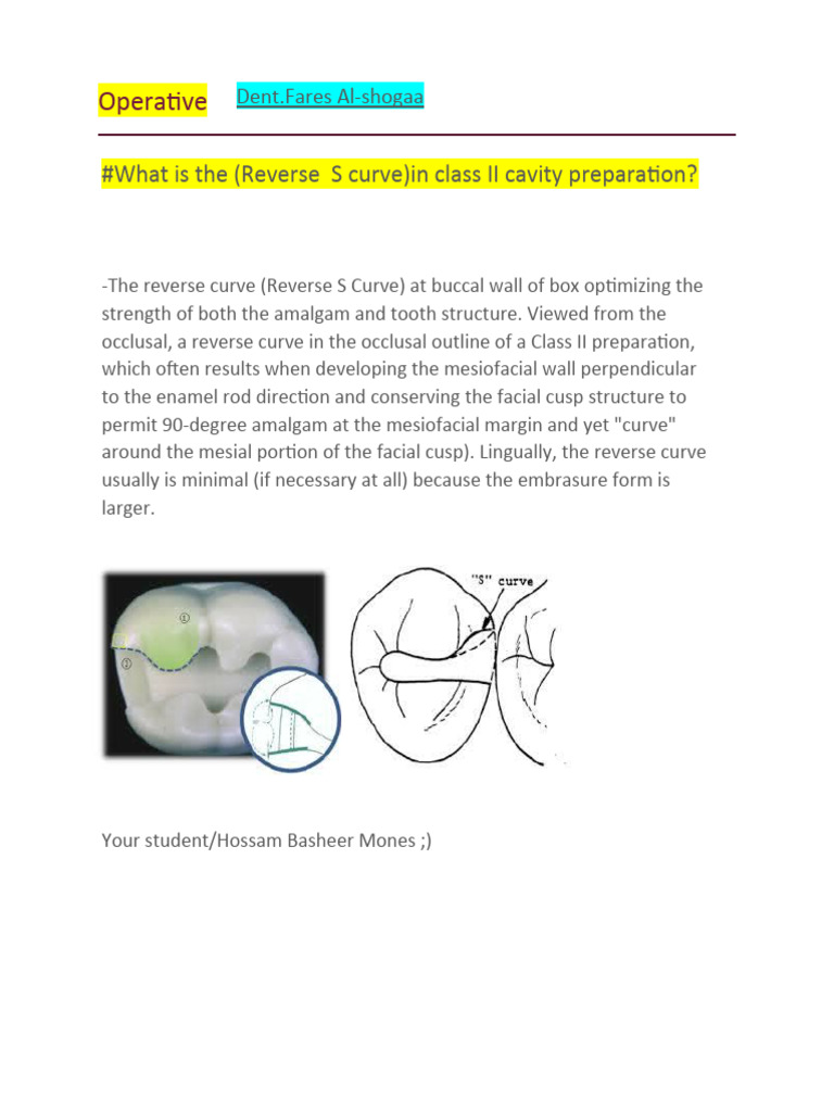 S Curve Pdf