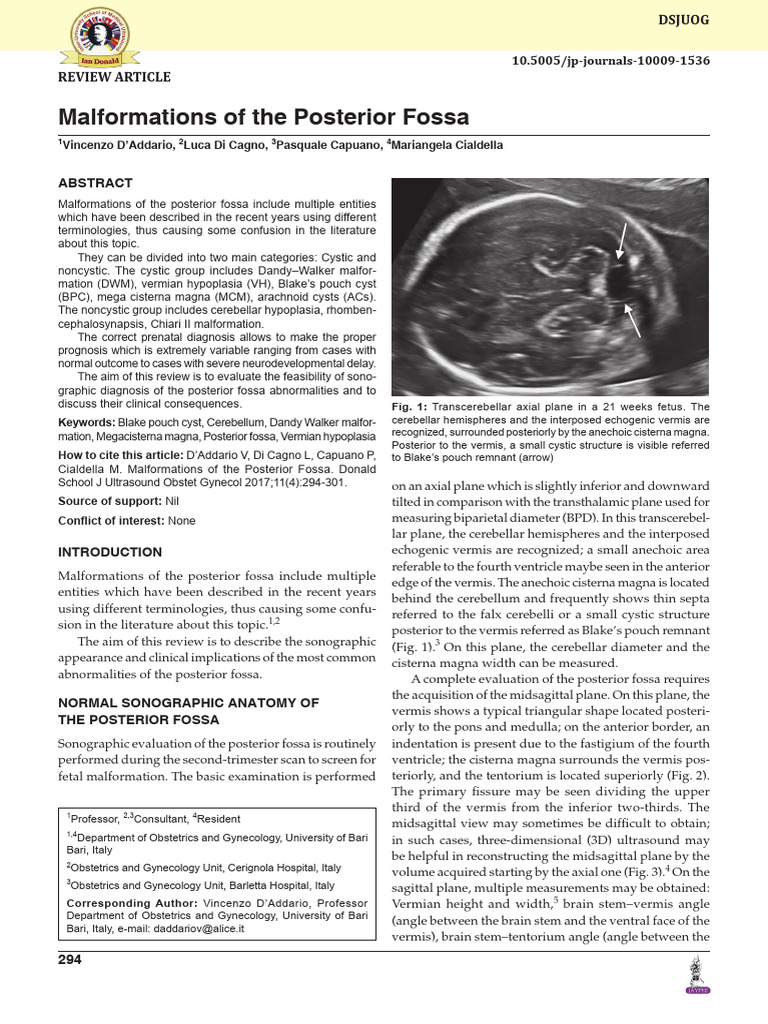 Posterior Fossa Malformations | PDF | Brain