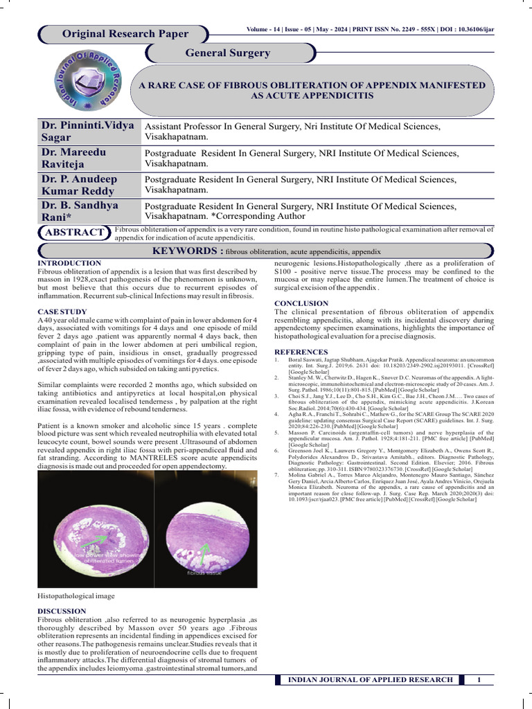 A Rare Case of Fibrous Obliteration of Appendix Manifested As Acute ...