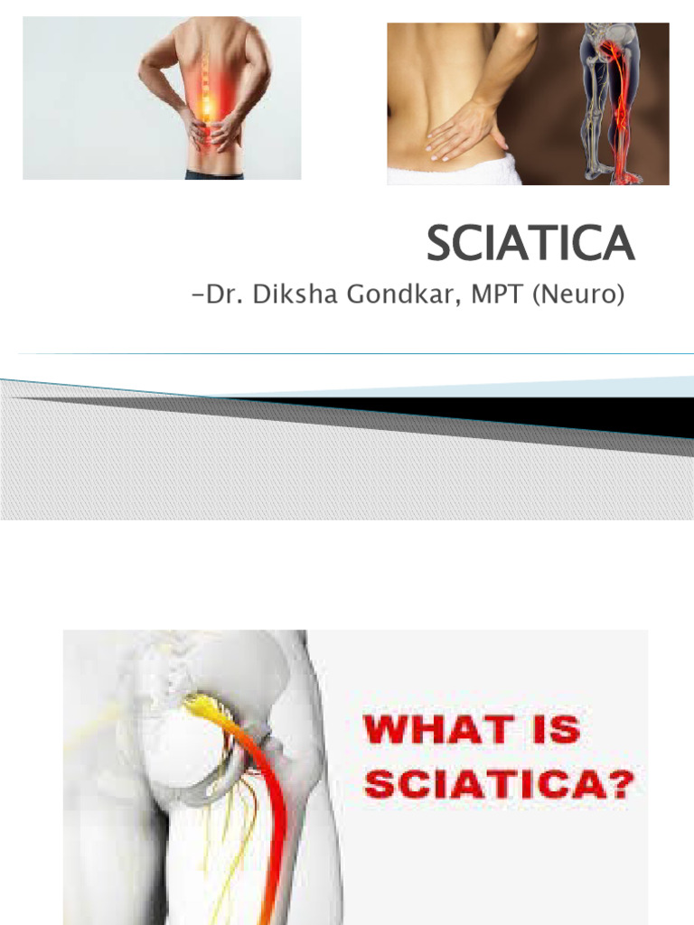Sciatica | PDF