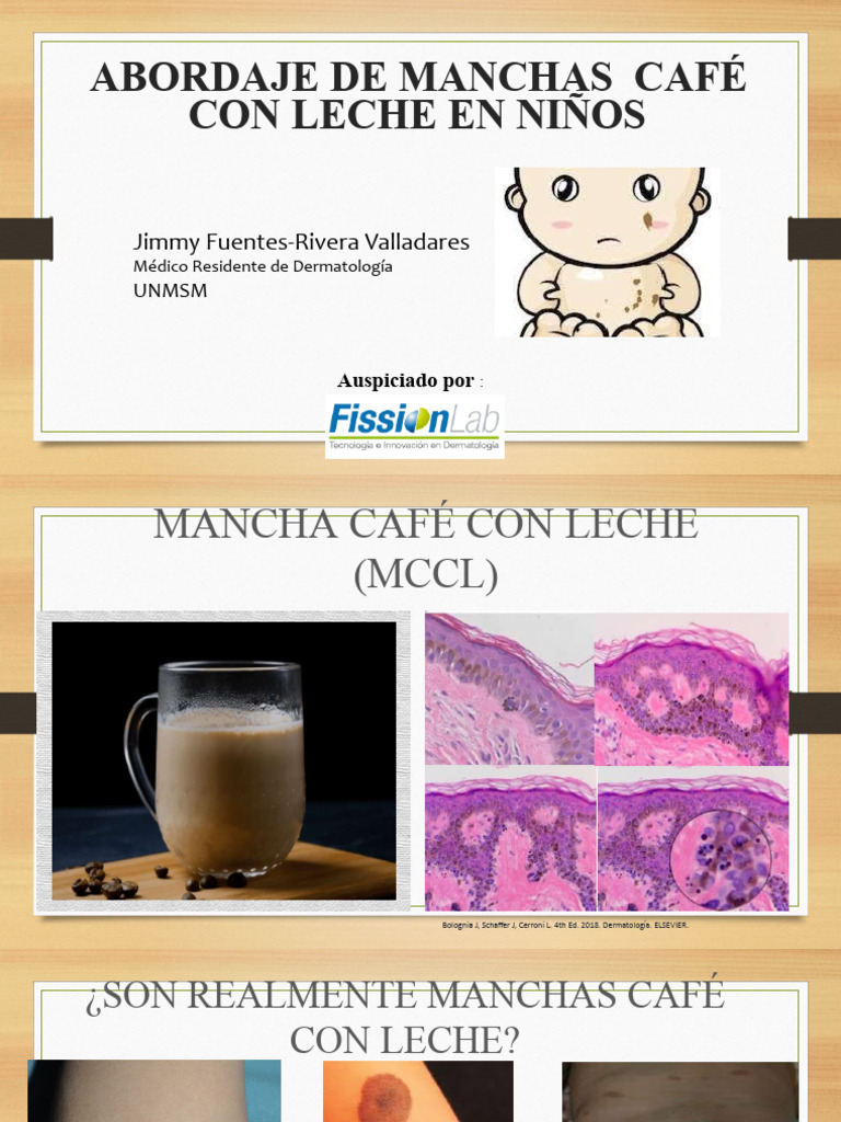 Diagnóstico de Manchas Café con Leche | PDF | Especialidades Medicas ...