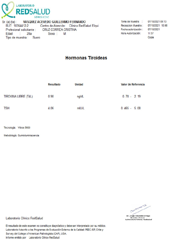 Tiroestimulante (TSH) | PDF