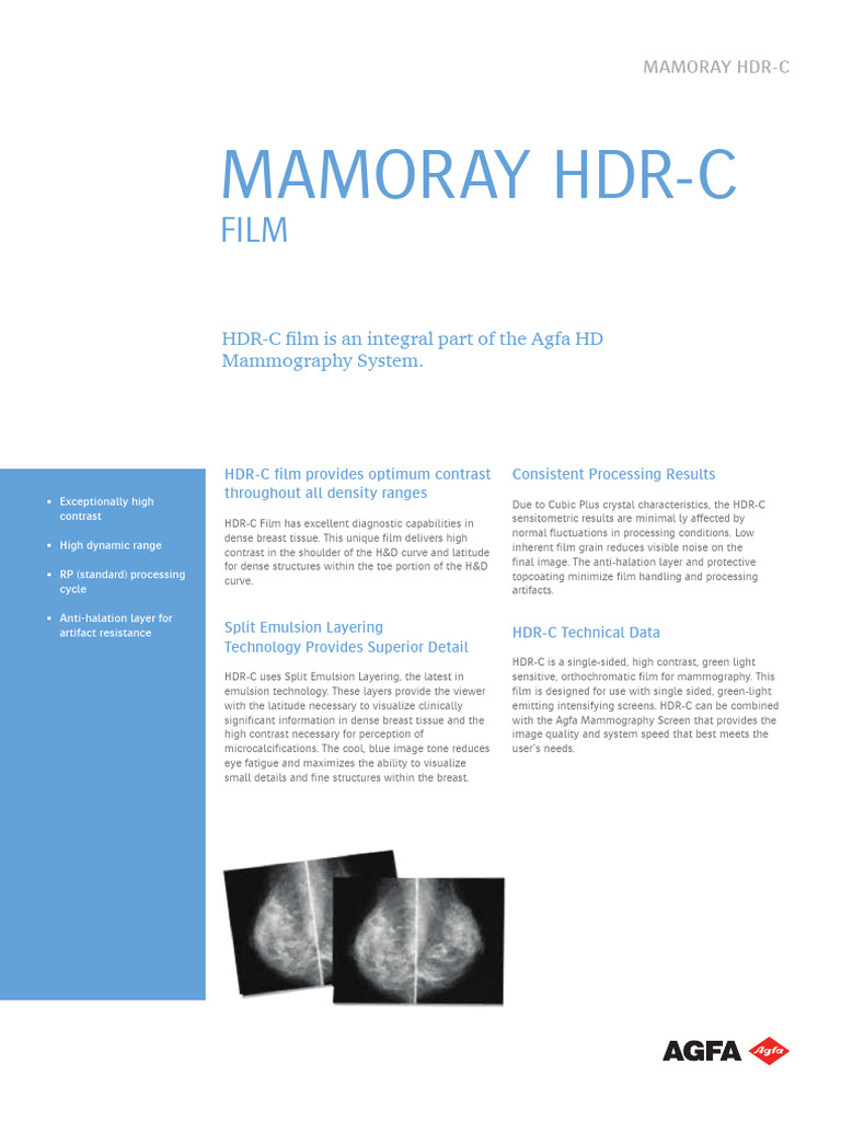 Mamoray HDR-C Film | PDF | Mammography | Breast Cancer