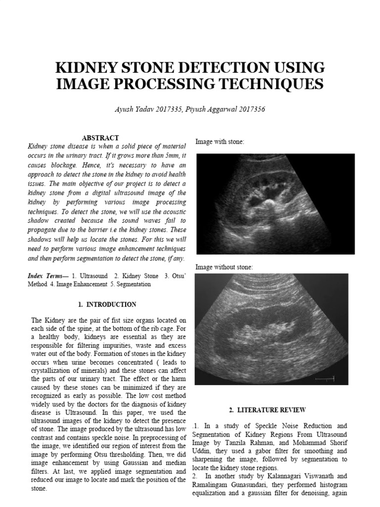 Report | PDF | Image Segmentation | Signal Processing