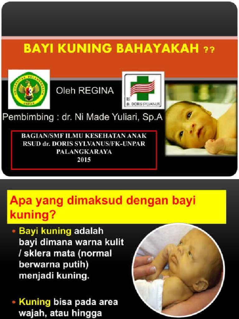 Mengenali Bayi Kuning Dan Penanganannya | PDF