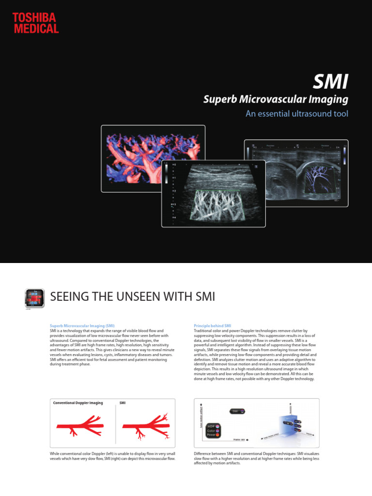 Super Microvascular Imaging (SMI) Overview | PDF | Medical Ultrasound ...
