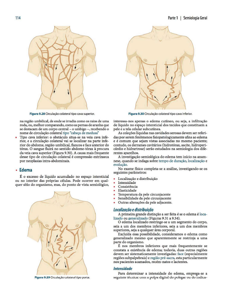 Semiologia Edema PORTO | PDF