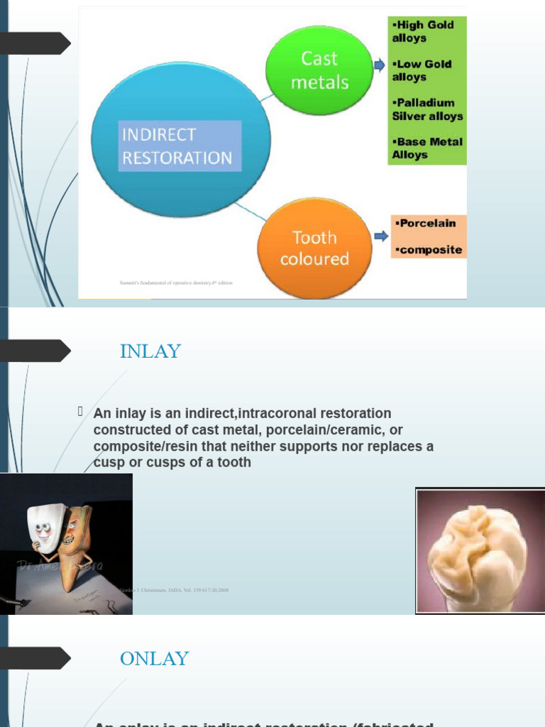Esthetic Inlays and Onlays | PDF | Mouth | Materials