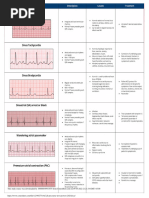Hallmark Signs and Symptoms PDF | PDF | Electrocardiography ...