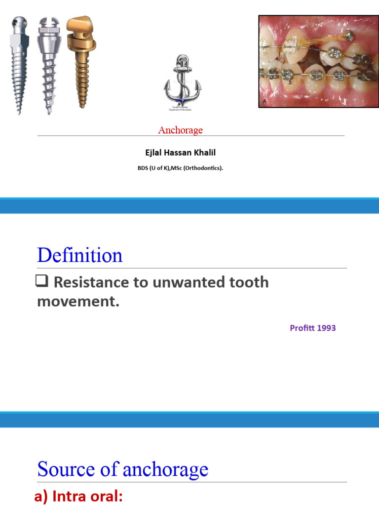 Understanding Orthodontic Anchorage Types | PDF | Orthodontics | Human ...