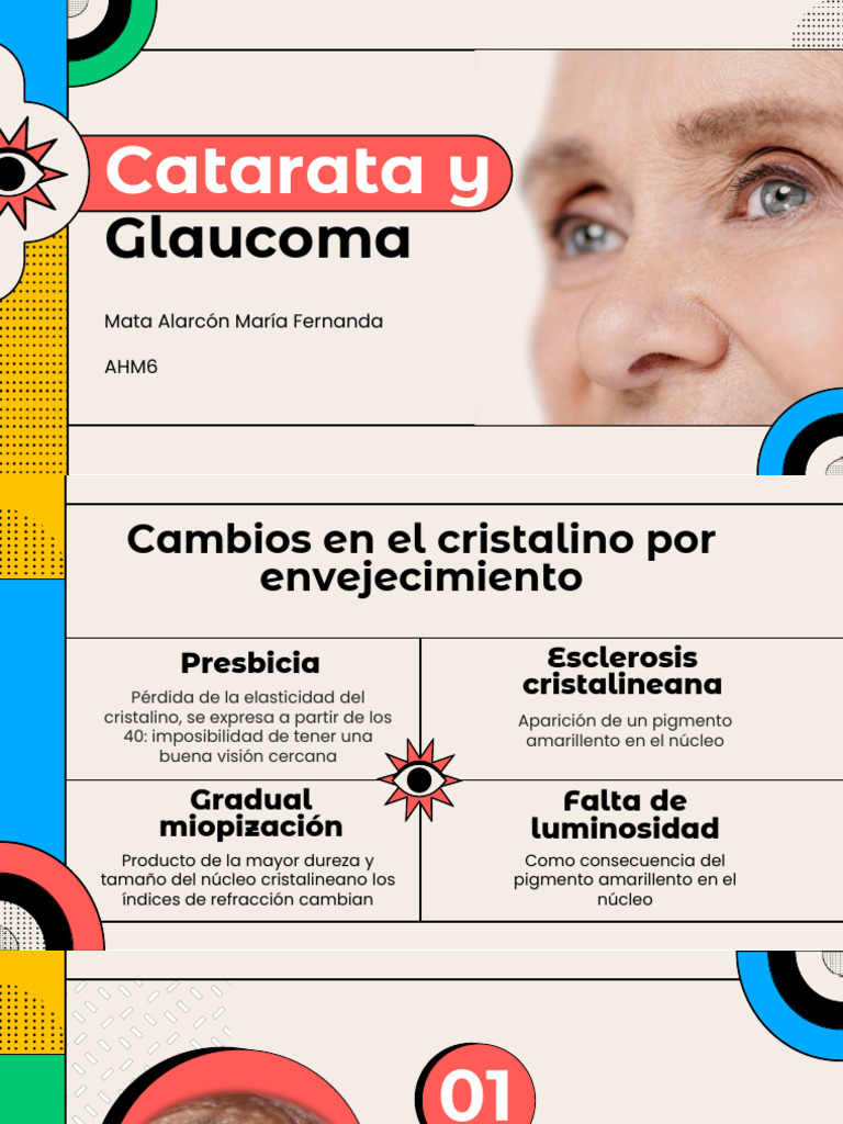 Catarata y Glaucoma | PDF | Glaucoma | Ojo humano