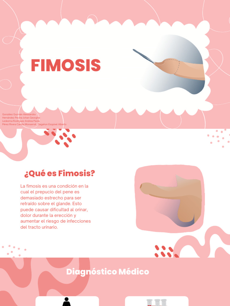 Fimosis: Causas, Diagnóstico y Tratamiento | PDF | Circuncisión ...