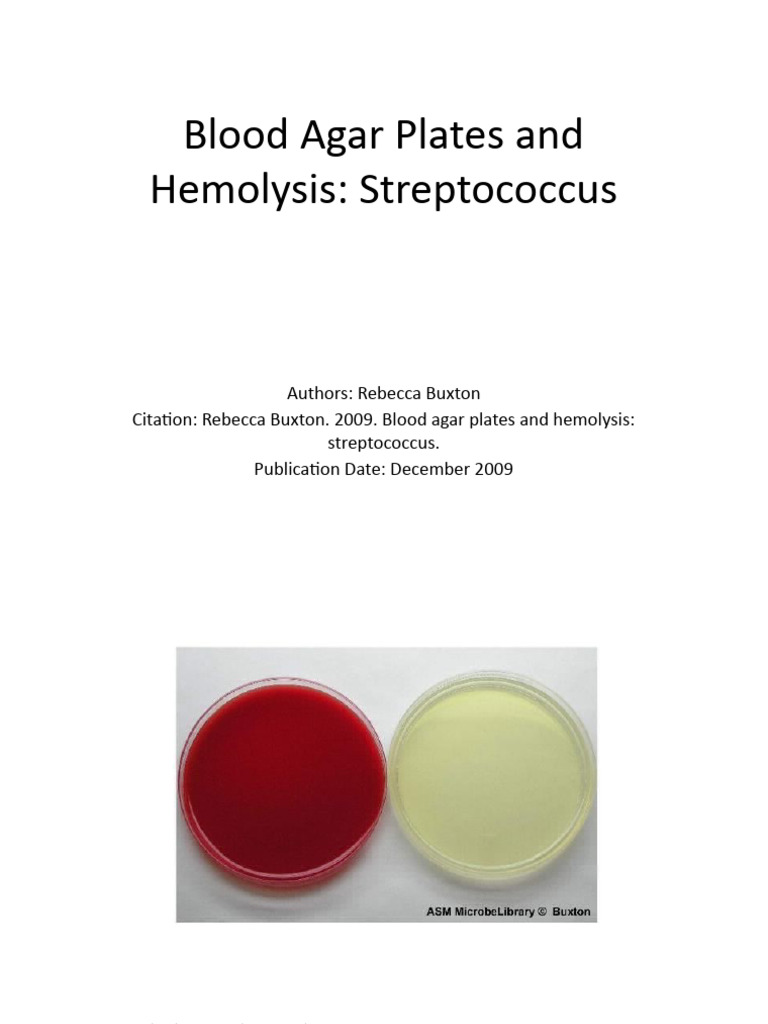 Blood Agar Plates and Hemolysis Streptococcus | PDF | Streptococcus ...