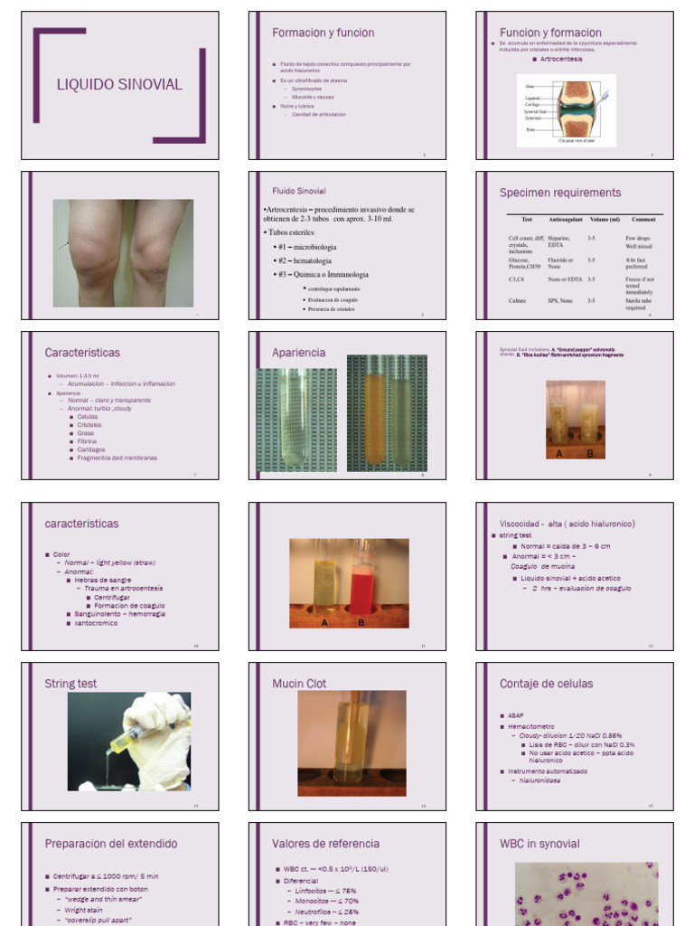 Fluido Sinovial | PDF | Gota | Especialidades Medicas