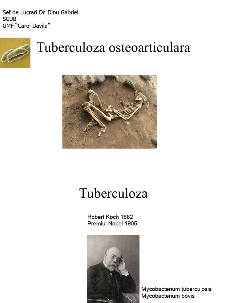 Curs 2 - Tuberculoza Osteoarticulara New | PDF