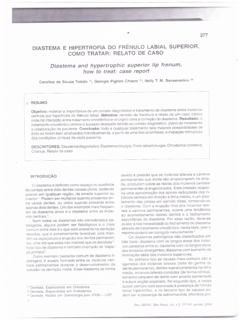 Diastema e Hipertrofia Do Frenulo Labial Superior | PDF