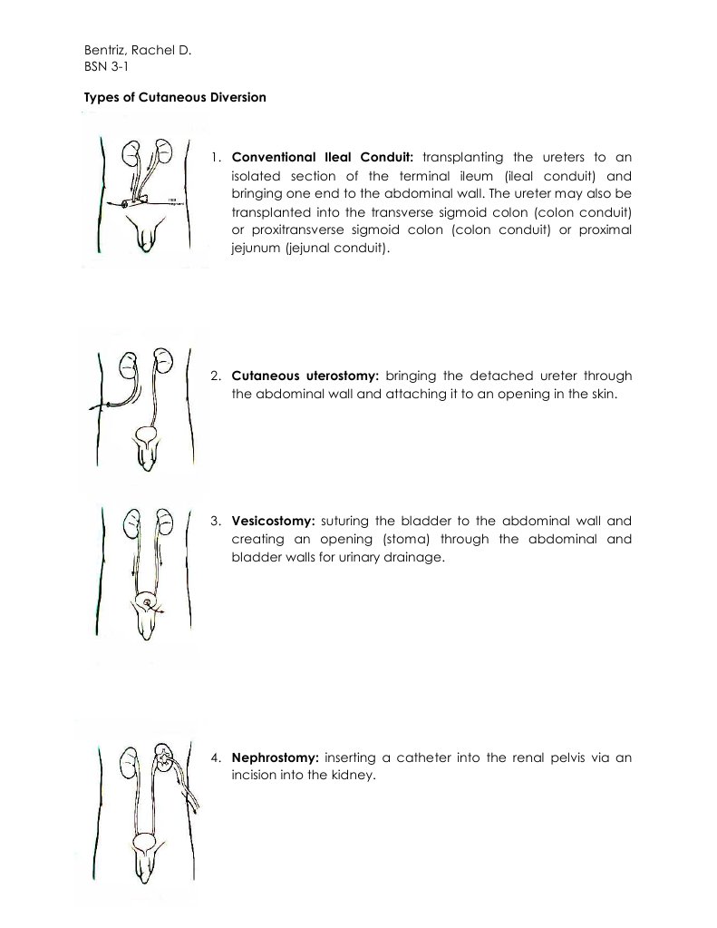 Types of Urinary Diversion Explained | PDF