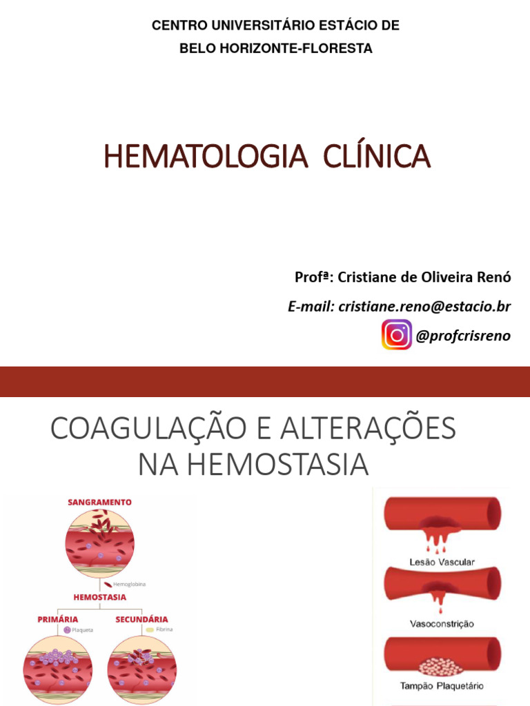 Aula 7 - Coagula o e Altera Es Na Hemostasia | PDF | Hemostasia ...