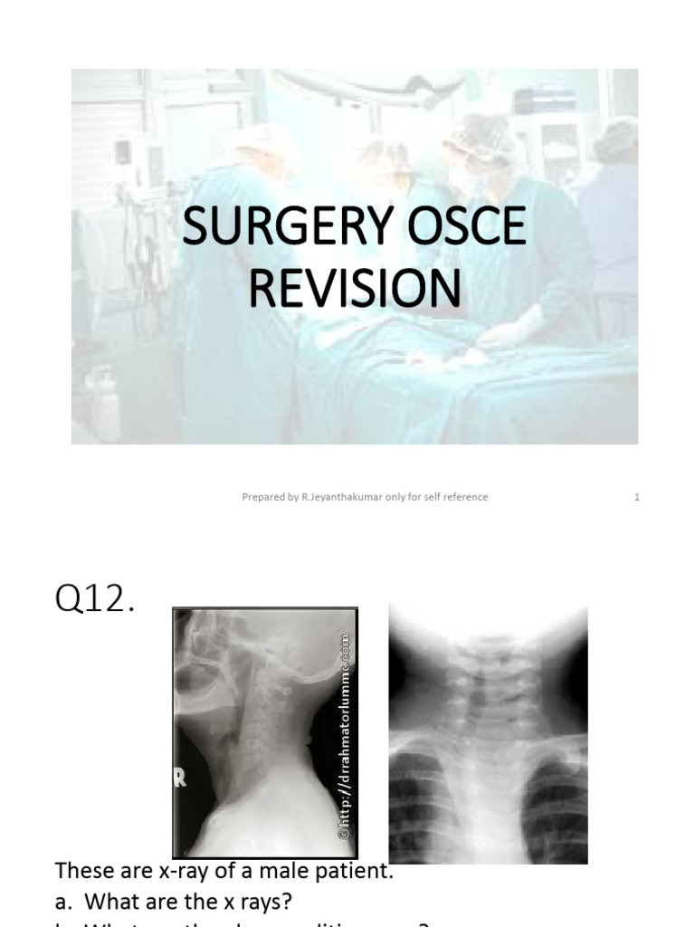 Surgery OSCE Questions | PDF | Diseases And Disorders | Medicine