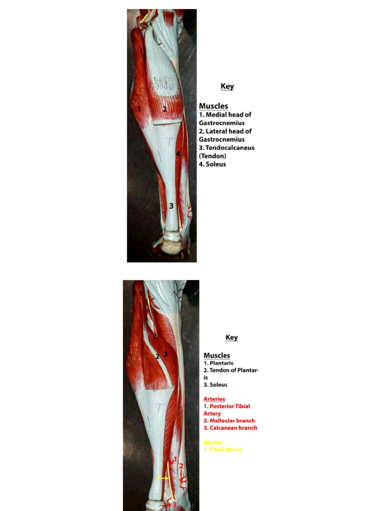 Anatomy Ospe MODELS EXPLAINED.. DR JUNAID J ONE MAN ARMY | PDF