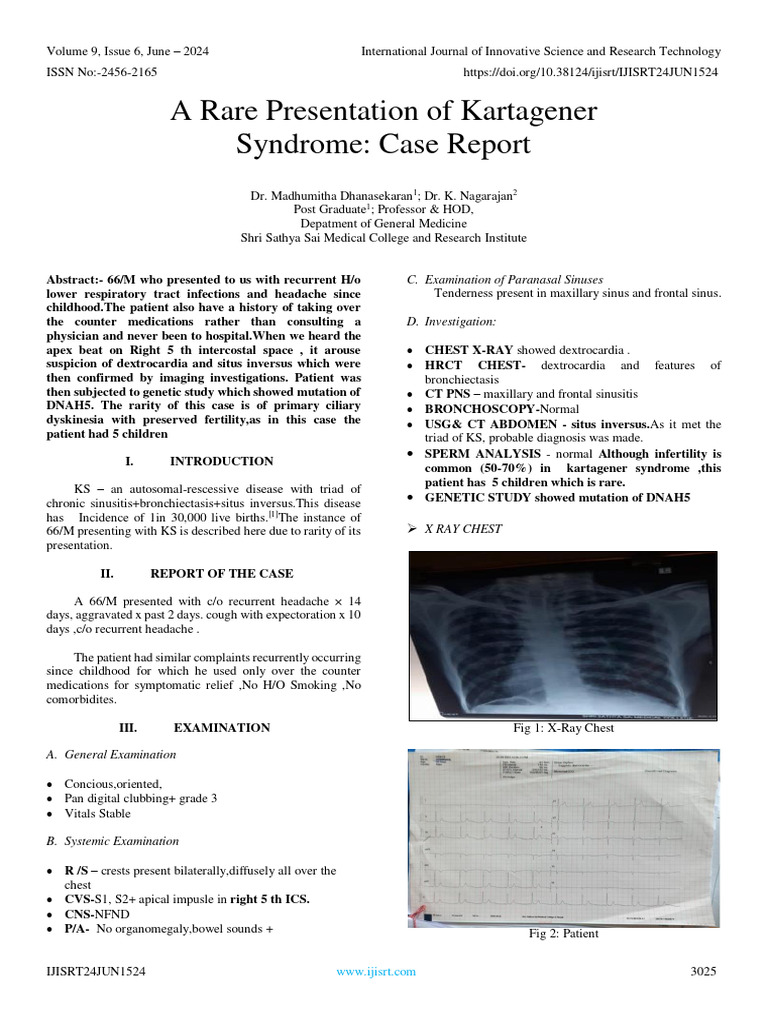A Rare Presentation of Kartagener Syndrome: Case Report | PDF ...