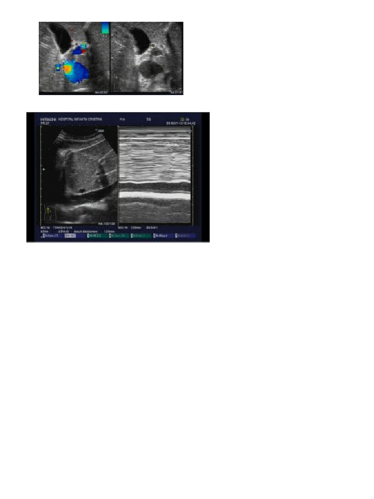 Manual de Ecografia Clínica | PDF | Ultrasonido | Ultrasonido médico