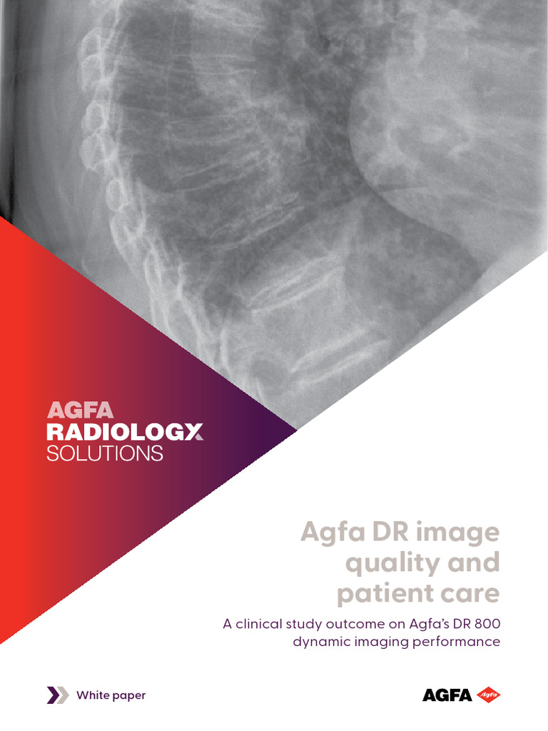 DR800 Dynamic Imaging (White Paper English) Feb 2024 | PDF | Radiology ...