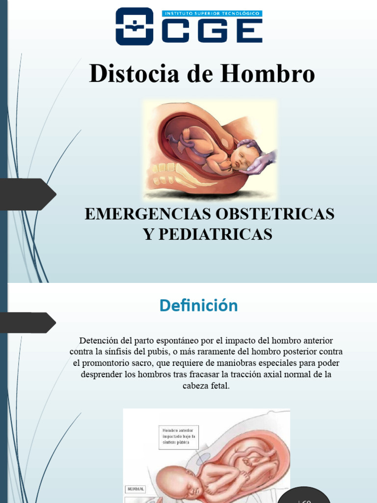 Distocias de Hombro | PDF | Parto | Seccion de cesárea