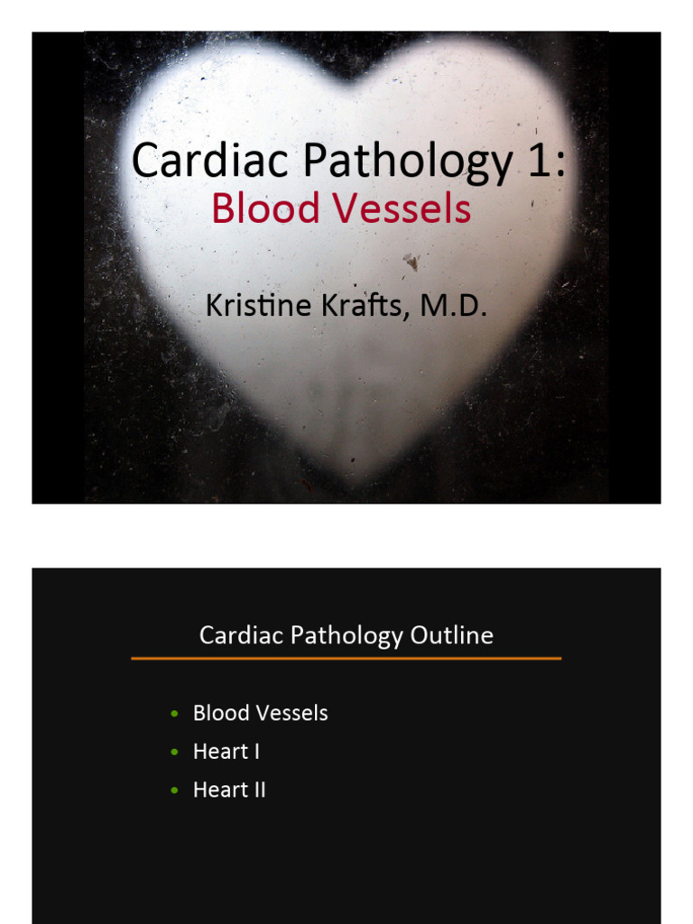 12 Cardiovascular Pathology I Color | PDF | Blood Vessel | Heart