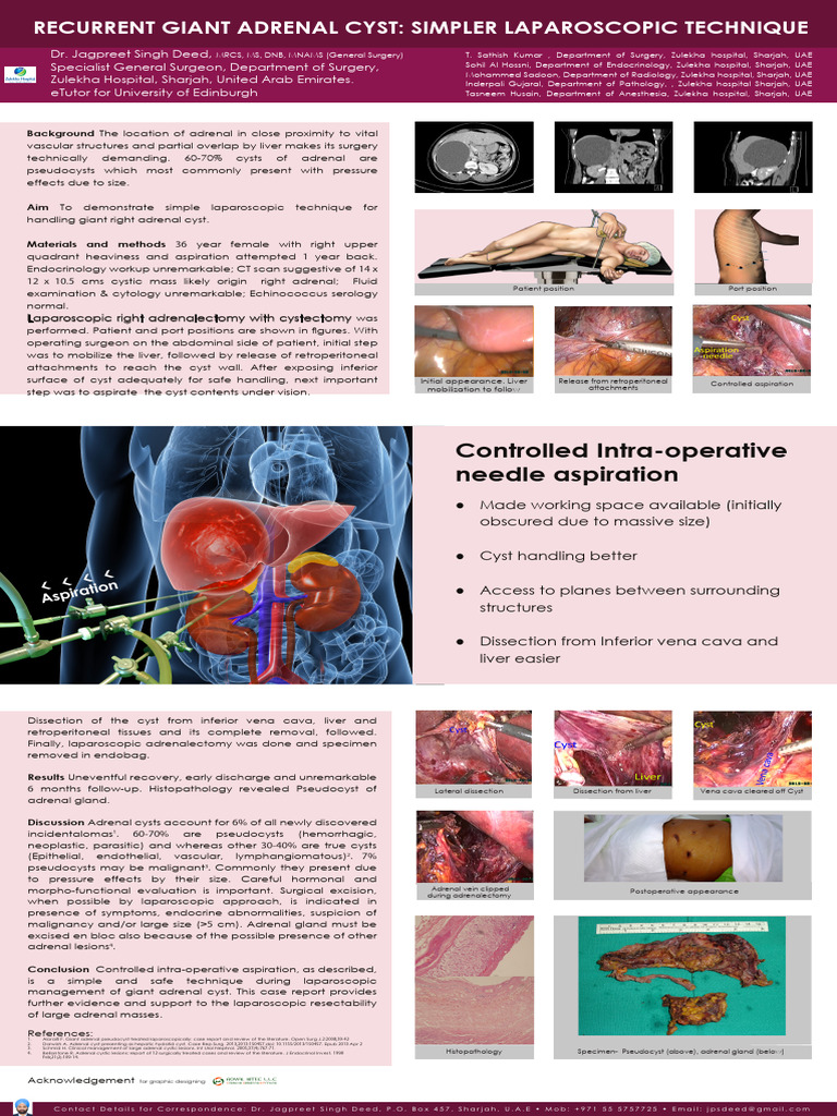 Recurrent Giant Adrenal Cyst: Simpler Laparoscopic Technique | PDF ...