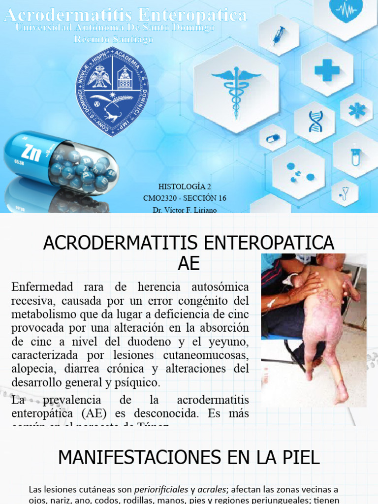 Acrodermatitis Enteropática: Manifestaciones y Tratamiento | PDF ...