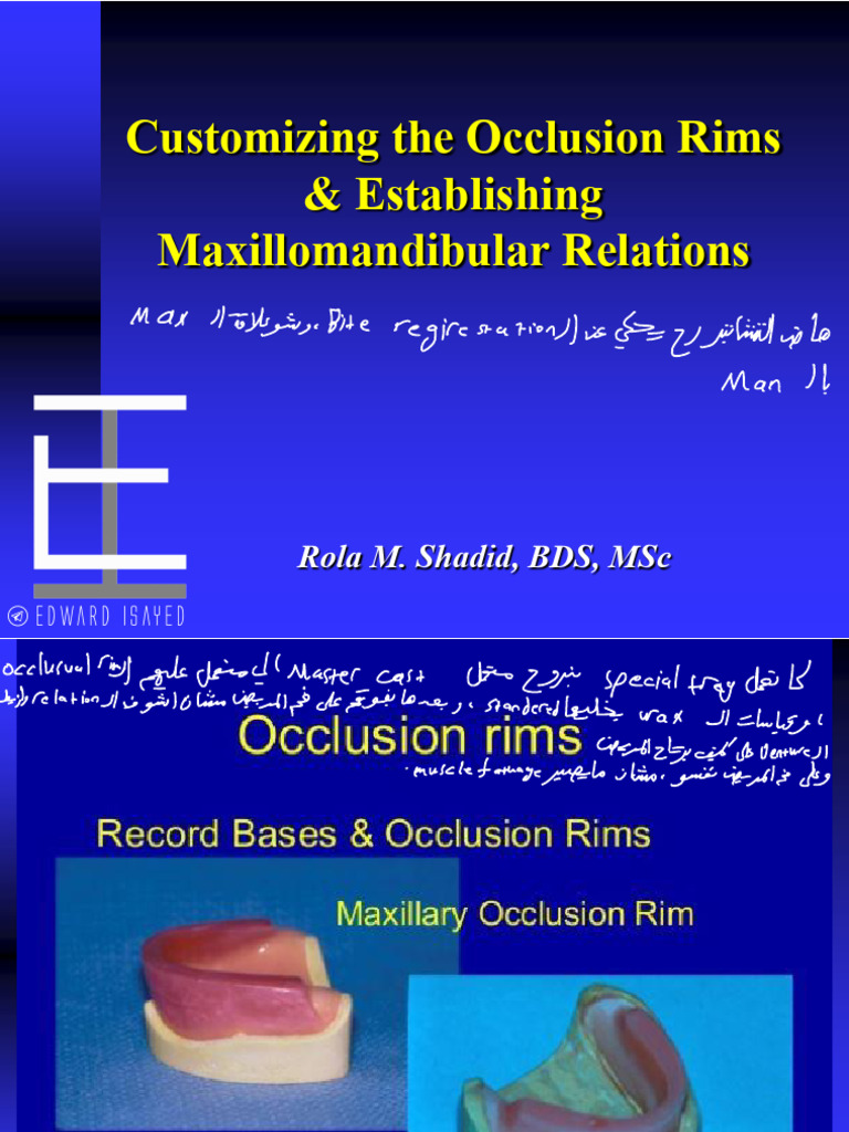 Prostho 8 | PDF | Dentures | Lip