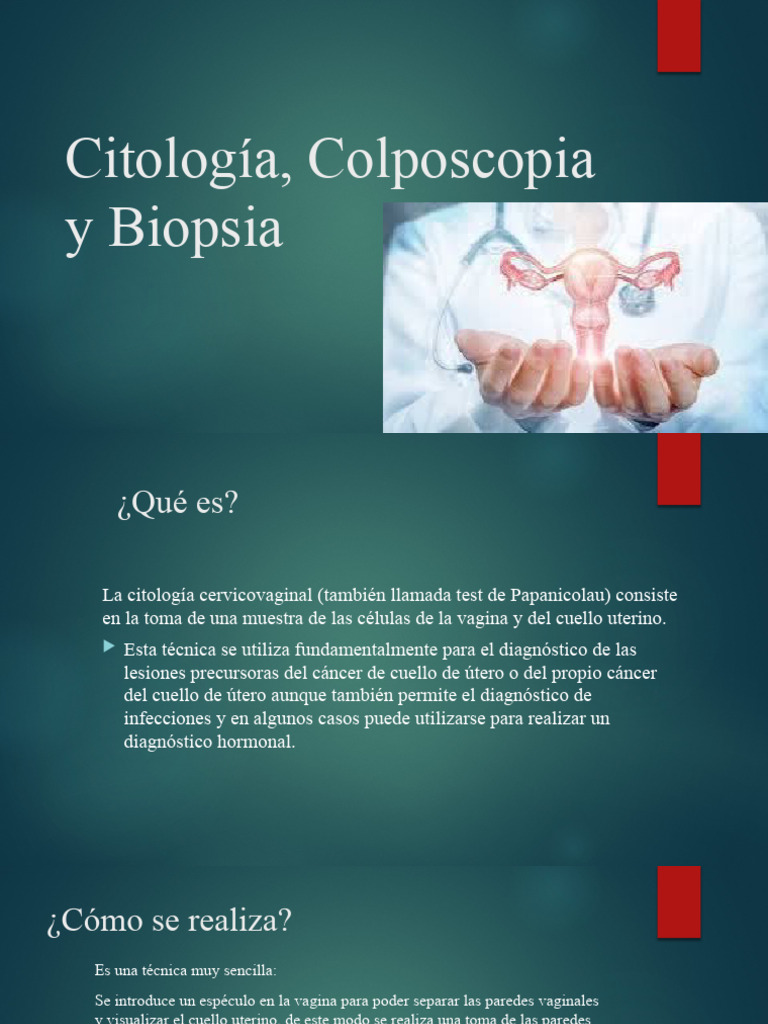 Citología, Colposcopia Biopsia | PDF | Vagina | Anatomia sexual