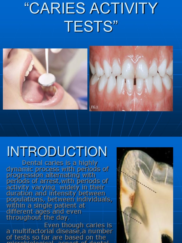 Caries Activity Test | PDF | Saliva | Medicine