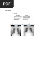 Evaluasi Foto Thorax Normal | PDF