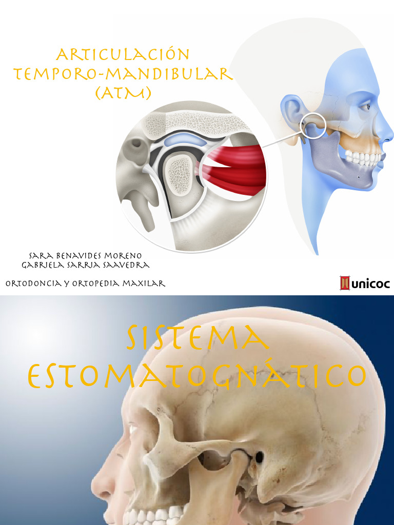 Articulación Temporo-Mandibular (ATM) : Sara Benavides Moreno Gabriela ...
