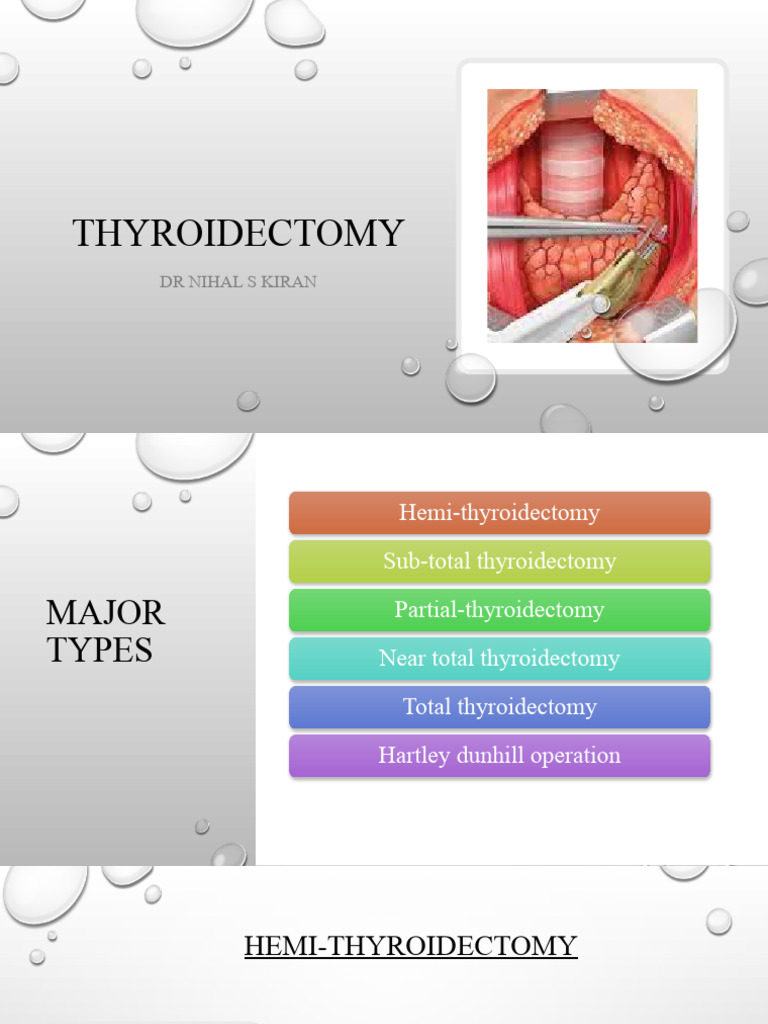 Thyroidectomy | PDF